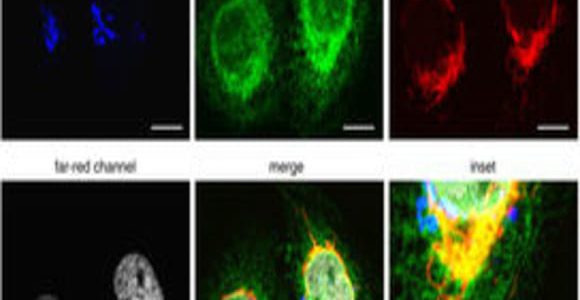 All Phases of Cell Cycle Visualized in Real Time - BioTechniques