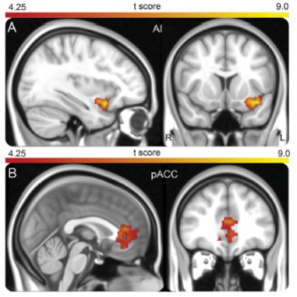 What is Consciousness and Where Does Consciousness Come From?