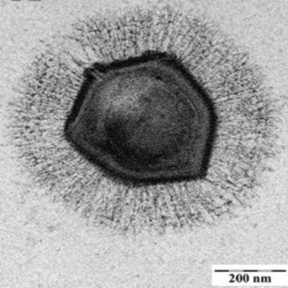 Giant Viruses: Enlarging the Domain of Viruses - BioTechniques