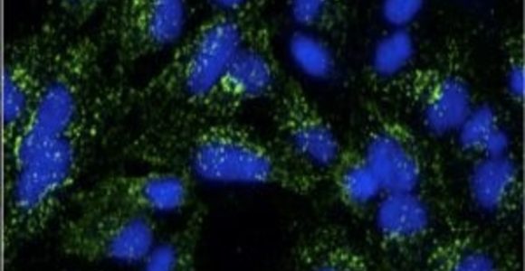 Exosome Tracking [New Method] - BioTechniques
