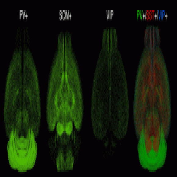 Male Brains vs. Female Brains: is the Difference in the (Cell) Numbers?