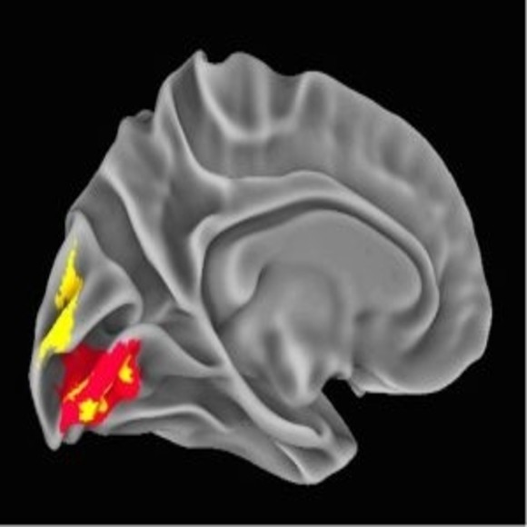 Neanderthal Footprints in the Modern Human Brain
