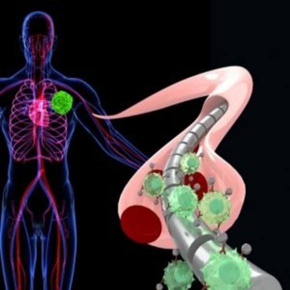 A Magnetic Wire Developed for Earlier Cancer Detection - BioTechniques