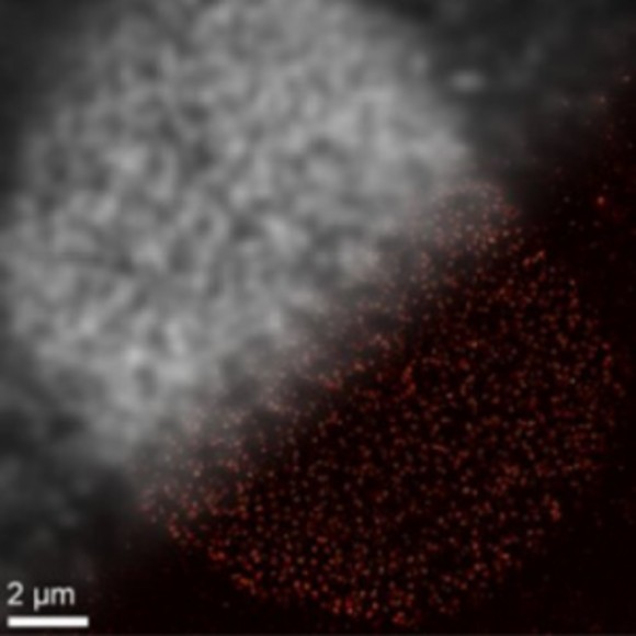 DNA-PAINT: Enhancing the Power of Super-Resolution Microscopy