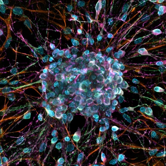 Memory Manipulation: The Key to Treating PTSD? - BioTechniques