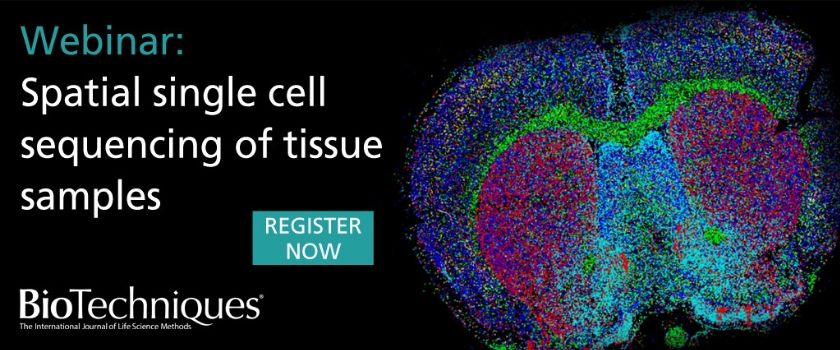 Spatial single cell sequencing of tissue samples - BioTechniques