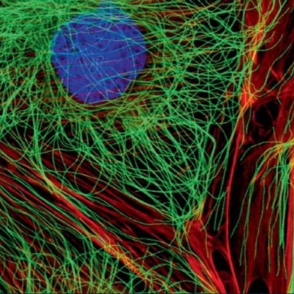 New Olympus Microscope Lenses Improve Image Quality - BioTechniques