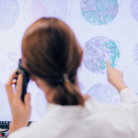 Aiforia translates images into new discoveries with deep learning AI ...