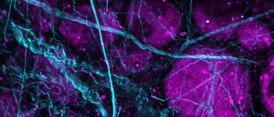 Biological Imaging with SHG and THG Microscopy - BioTechniques