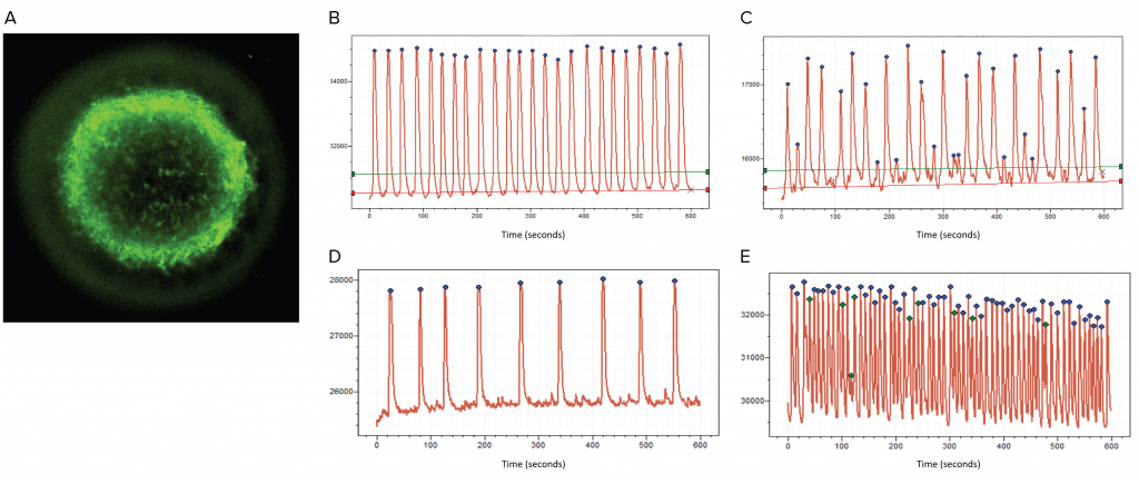 Advancing Understanding of Neurological Disorders - BioTechniques