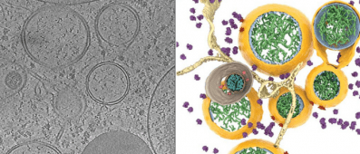 Cryo-EM: Taking The Study of Disease By Storm - BioTechniques