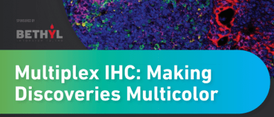 Infographic - Mutiplex IHC: Making discoveries multicolor - BioTechniques