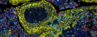 Antibody validation for successful immunohistochemistry and multiplex immunofluorescence ...