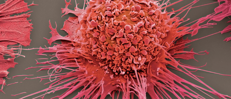 Neutrophil Web Catches Bacteria for Phagocytosis - BioTechniques