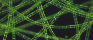 Shapeshifting Bacteria Use Filamentation to Infect Cells - BioTechniques