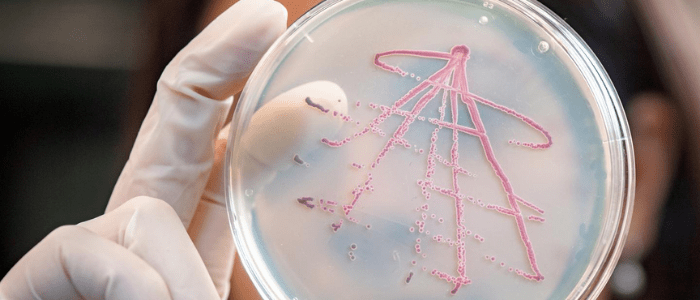 Shapeshifting Bacteria Use Filamentation to Infect Cells - BioTechniques