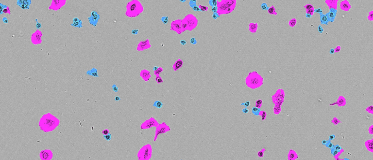 Incucyte® advanced label-free classification - BioTechniques