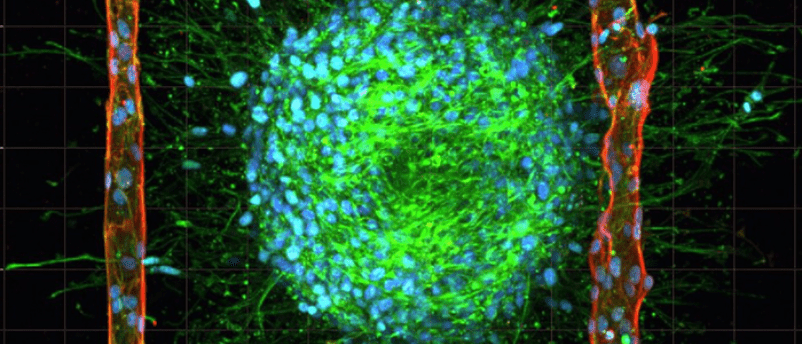 Top 5 Biomedical Hydrogel Applications - BioTechniques