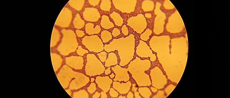 Advances in Membrane Filtration - BioTechniques