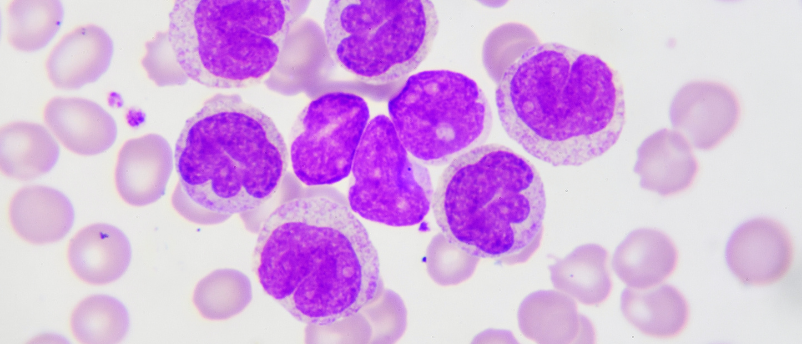 Targeting Induced Mitophagy for Leukemia - BioTechniques