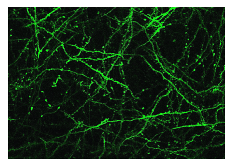 Imaging the brain with multi-photon microscopy - BioTechniques