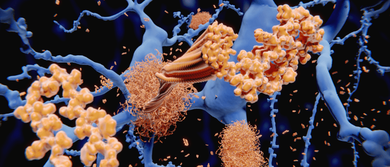 Developing Diagnostics for ATTR Amyloidosis - BioTechniques