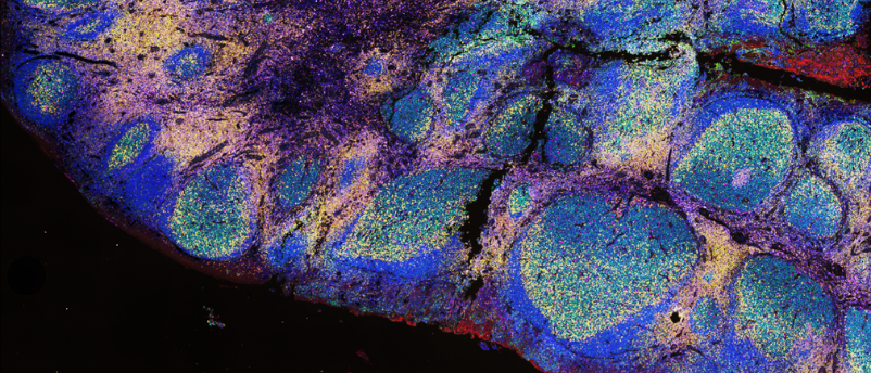 Infographic: Multiplex immunofluorescence technologies explained ...