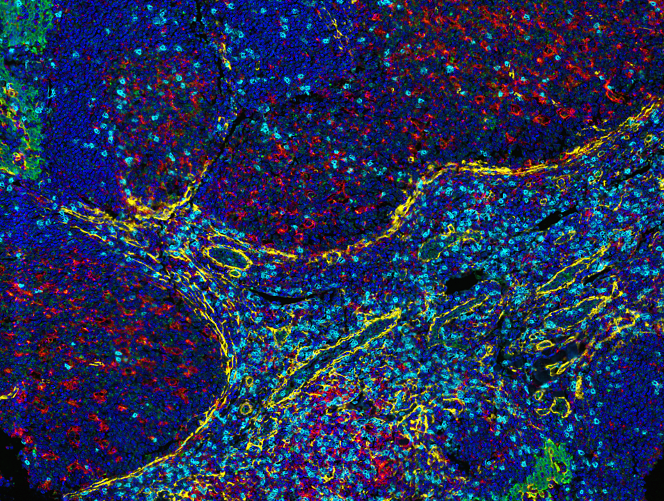 Multiplex immunofluorescence for cancer research - BioTechniques