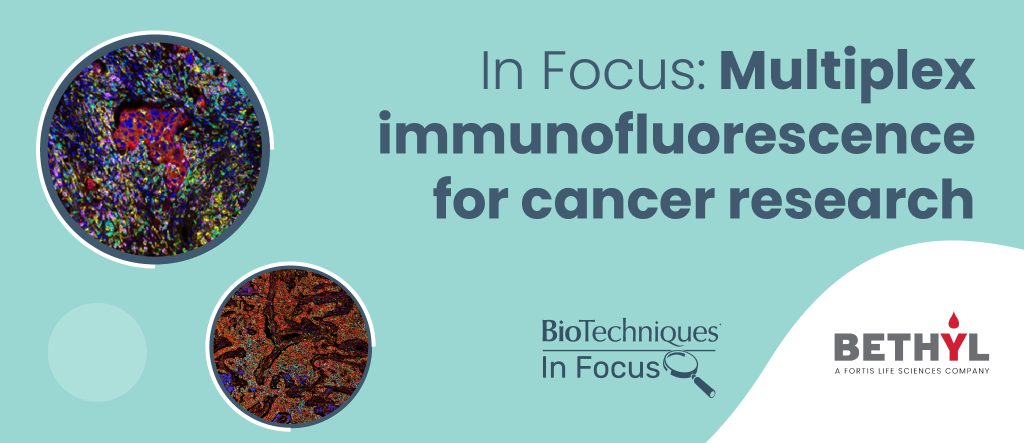 Multiplex immunofluorescence for cancer research - BioTechniques