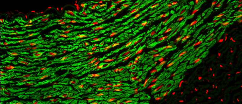 Multiplex mIHC: making discoveries in multicolor - BioTechniques