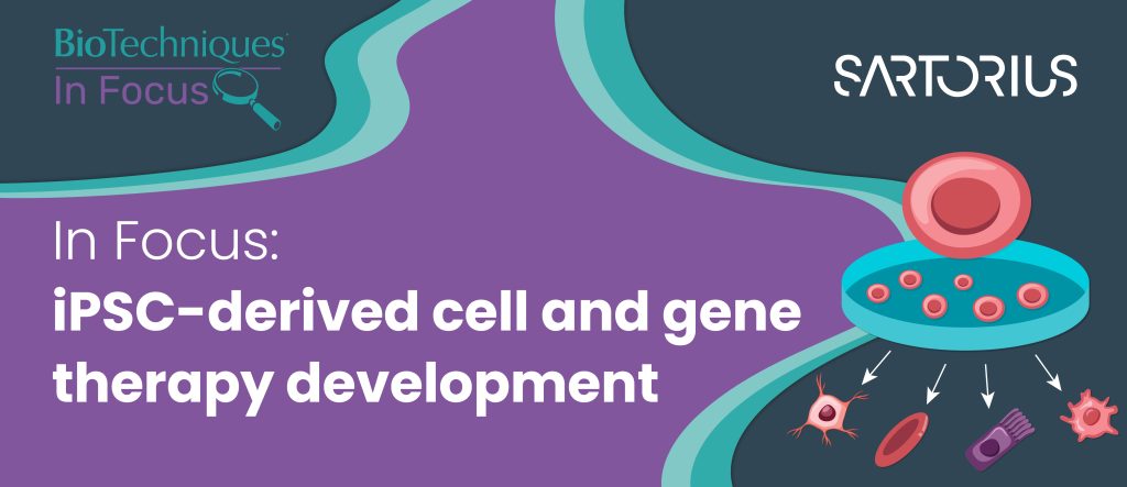 iPSCs for cell and gene therapies - BioTechniques