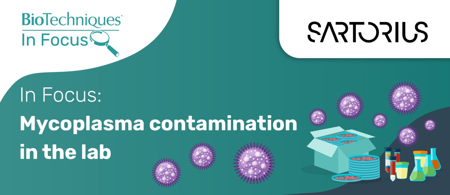 Mycoplasma contamination in the lab - BioTechniques