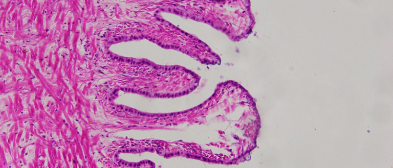 GPSA Virtually Realigns 2D Tissue Slices - BioTechniques