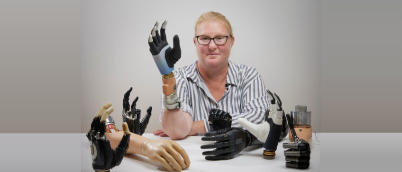 Most Advanced Prosthetic Arm 2022