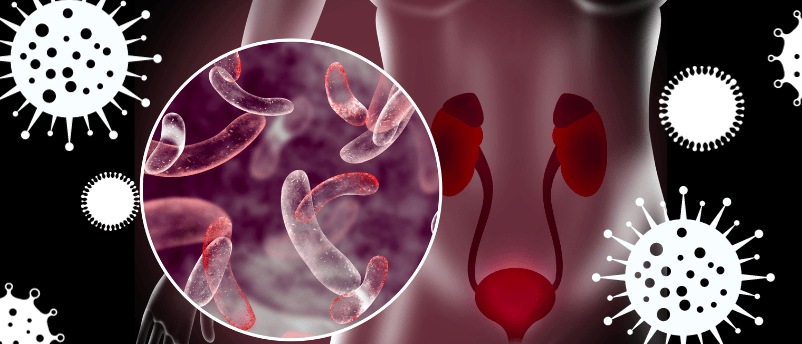 UTIs: Improving Treatment and Diagnosis with 3D Bladder Models ...