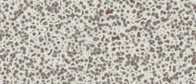 Application Note: Label-free, real-time live-cell assays for 3D ...