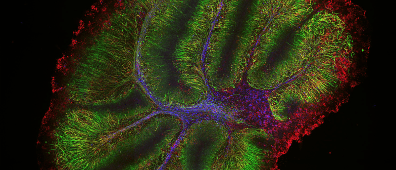 White Paper: Next-generation SilVIR detector system for the FLUOVIEW ...