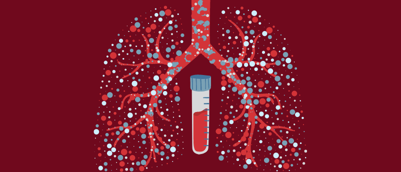 A rapid test for diagnosing nontuberculous mycobacteria infection ...