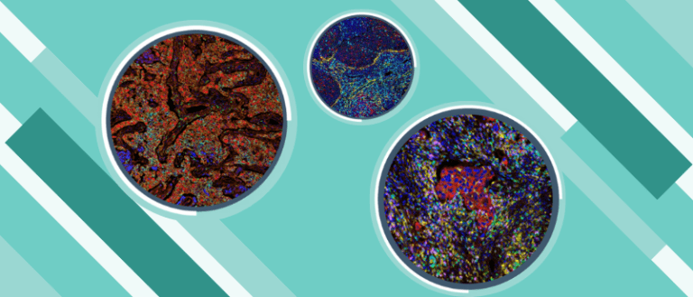 In Focus Wrapped: Multiplex immunofluorescence for cancer research ...