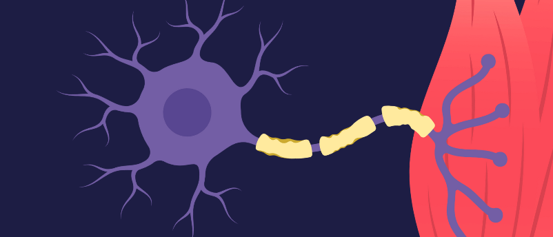 New ALS Gene Discovered - BioTechniques