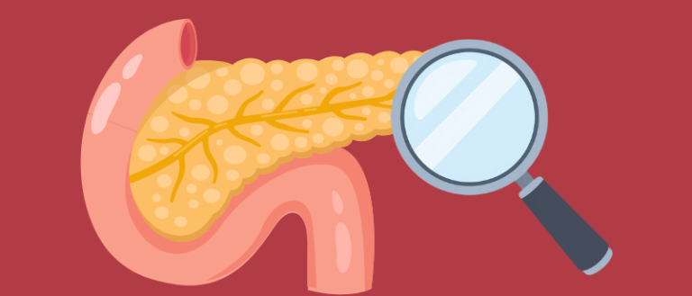 Developing Pancreatic Organoids - BioTechniques