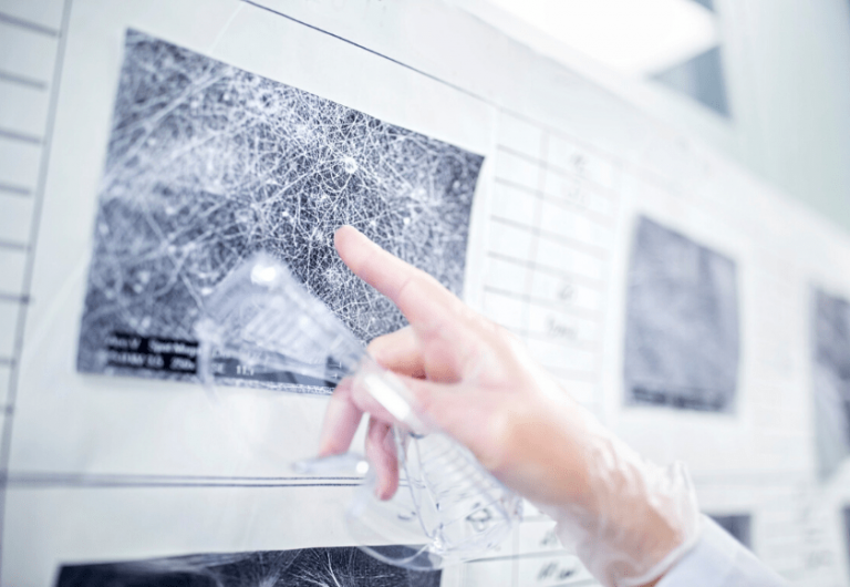 Bioengineered Heart Valves Grow With Recipient - BioTechniques