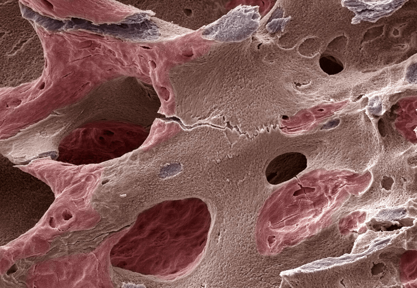 Structure of biomaterials plays an important role in endogenous bone ...