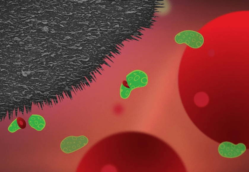 Graphite nanoplatelets in medical devices can help prevent infections ...